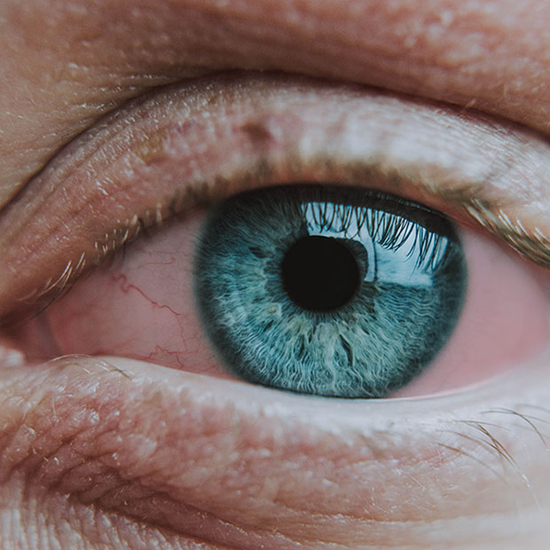 Types and Treatment of Pink Eye – Fresno CA | Fig Garden Optometry